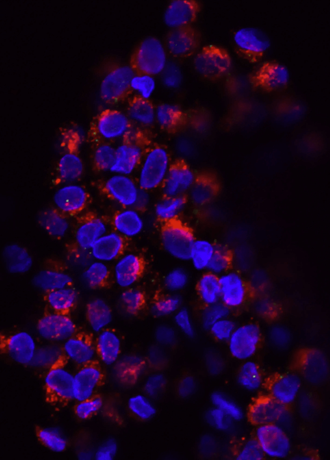 CRISPR-edited Knockout iPSC Line | EditCo