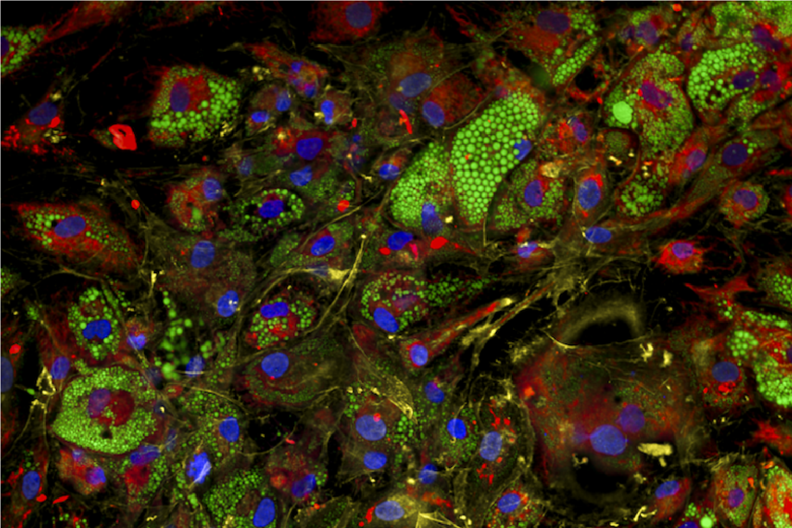 EditCo Bio | Pathway Analysis